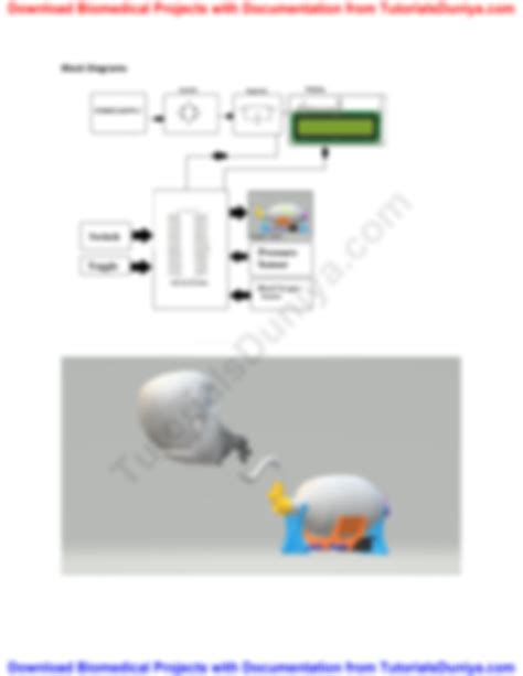 Image result for DIY Ventilator Using Arduino RSP 266