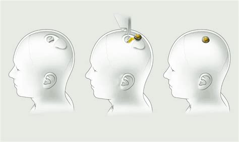 Image result for Computer Chip Brain