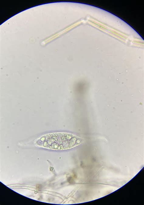 Image result for 400X Microscope