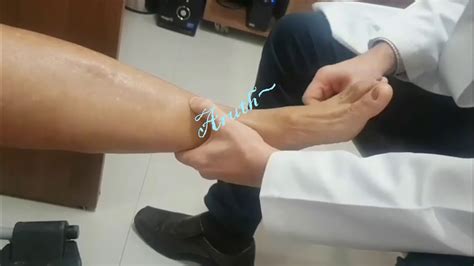 Image result for Chaddock Reflex Video