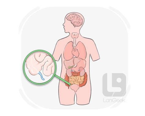 Image result for Appendix WHA Is It