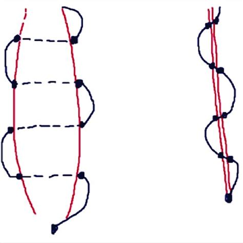 Image result for Closure into Triangle Examples