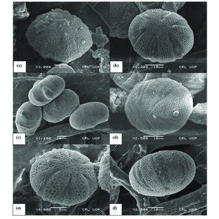 Light microscope microphotographs at 1000× magnification. A: equatorial ...