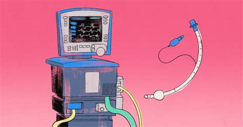 Image result for Different Types of Intubation