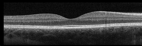 Image result for Oct Check