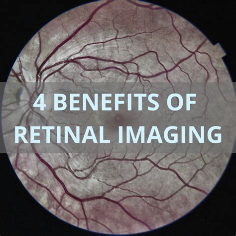 Image result for Retinal Imaging