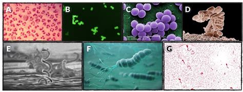 Image result for Morphological Traits Examples