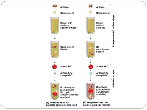 Image result for CFT Test Complement Fisation Test