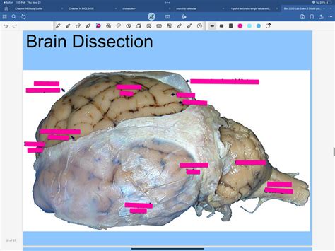 Image result for Brain Dissection