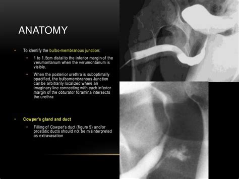Image result for Urethrogram Technique