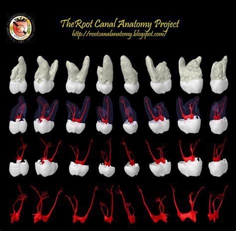 The Root Canal Anatomy Project: Maxillary First Molar