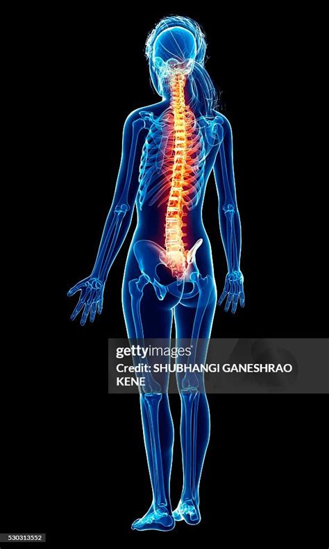 Image result for Back Pain in Computer
