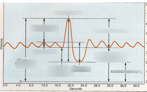 Image result for How to Read Spirogramm