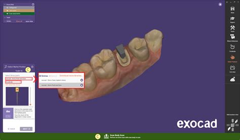 Image result for G Code From Exocad File