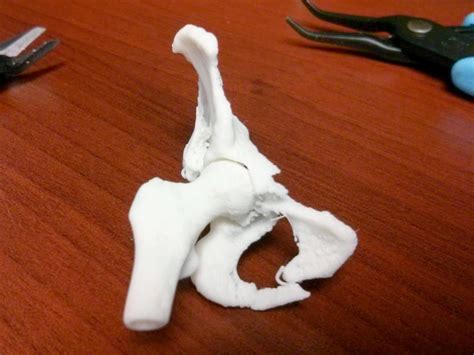 Image result for 3D Scan Medical