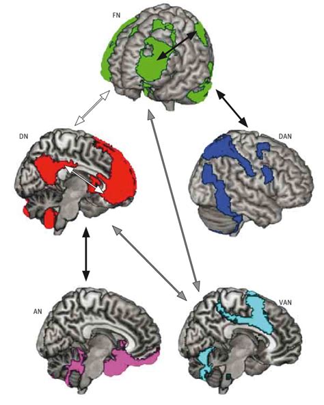 Image result for Cognitive Dysfunction in Mdd
