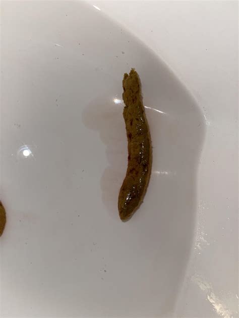 Image result for Red Poop Beets