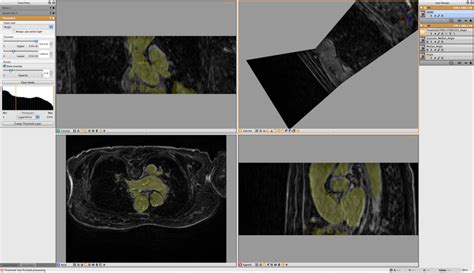 Image result for Seg3d Tutorial