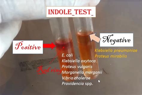 Image result for Indole Test Procedure