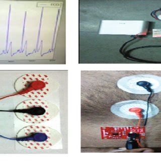 Image result for Wireless ECG Monitor Using Raspberry Pi