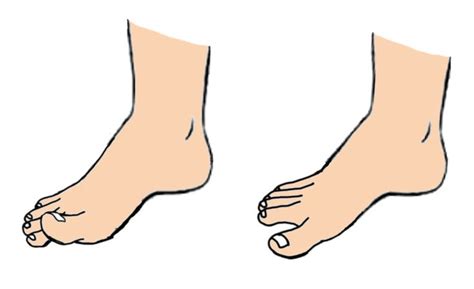 Image result for Small Toe Excercise