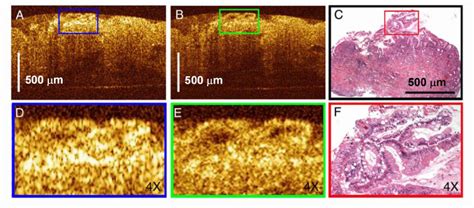 Image result for Oct Axial Resolution