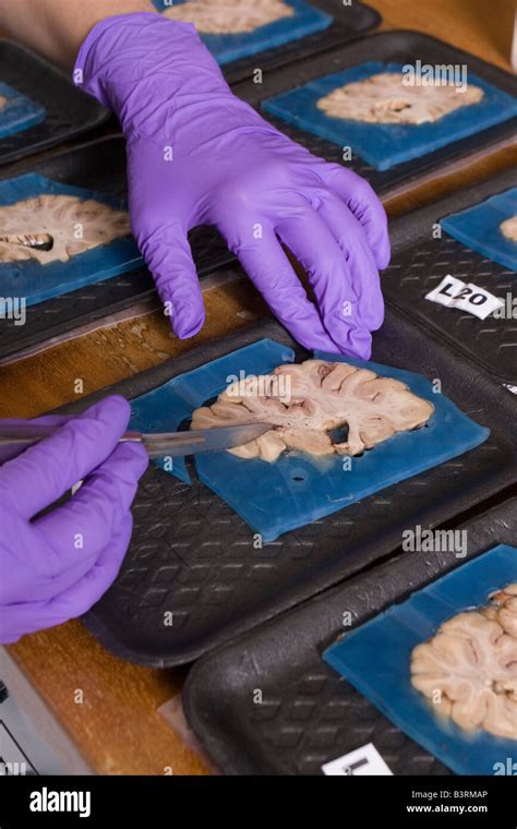 Image result for Brain Dissection