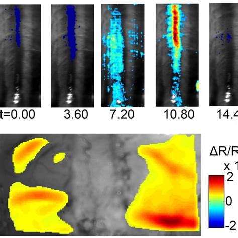 Image result for Oct Line Scan