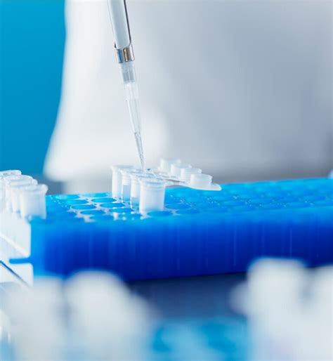 Image result for Sampling Methods for Clinical Laboratory