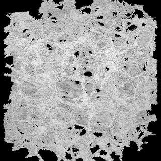 Image result for Trabecular Bone Structure