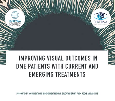 Image result for DME Tutorial