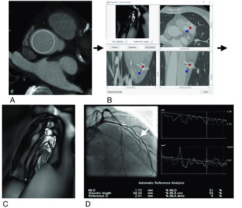 Image result for Image Processing Algorithm for DICOM Images