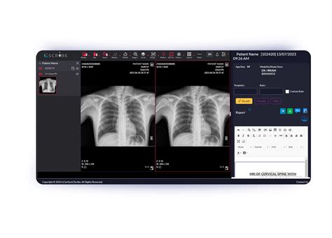 Image result for Using Escribe