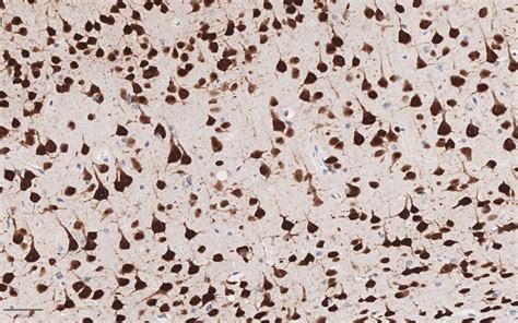 Image result for Multiplex IHC Neun