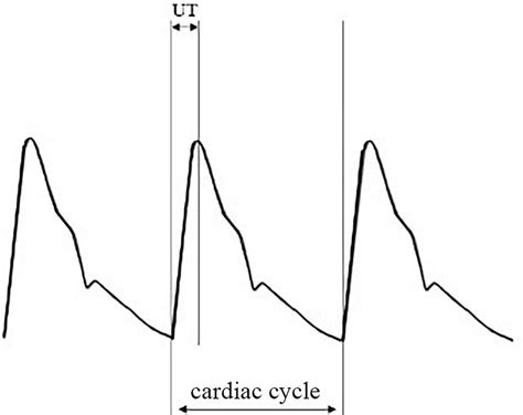 Image result for PVR Recording