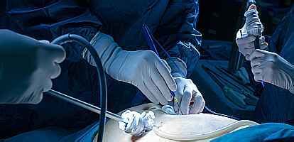 Image result for Prostate Operation Procedure