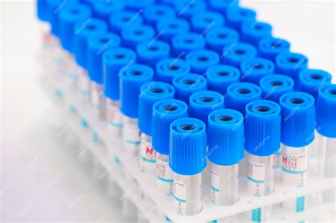 Image result for Tube Test Procedure