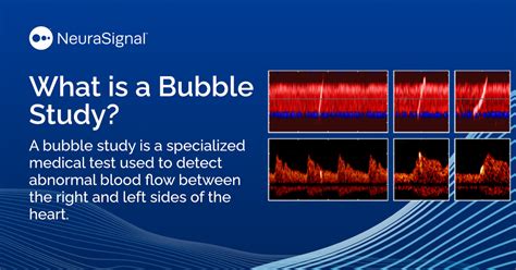 Image result for Delayed Bubble Study