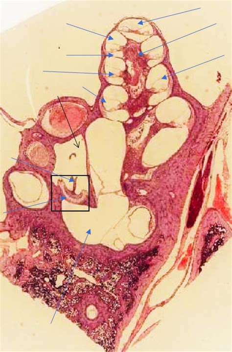 Image result for Inner Ear Shutterstock Exploding Box