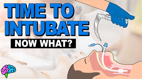 Image result for How to Intubate