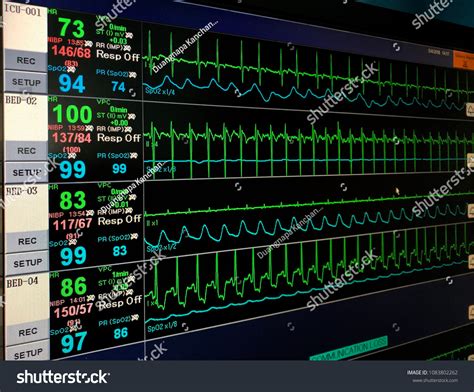 Image result for Telemetry Monitor