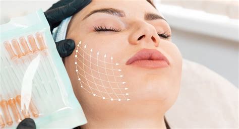 Image result for Thread Lifting Face