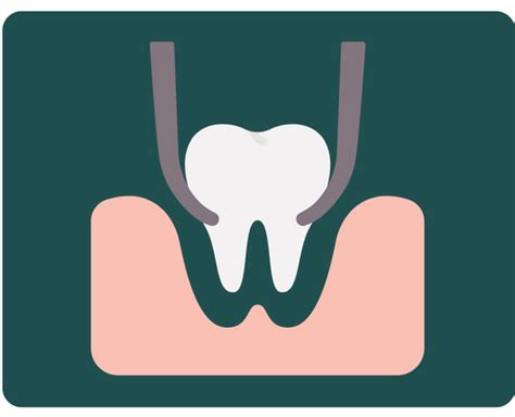 Image result for Surgical Tooth Extraction