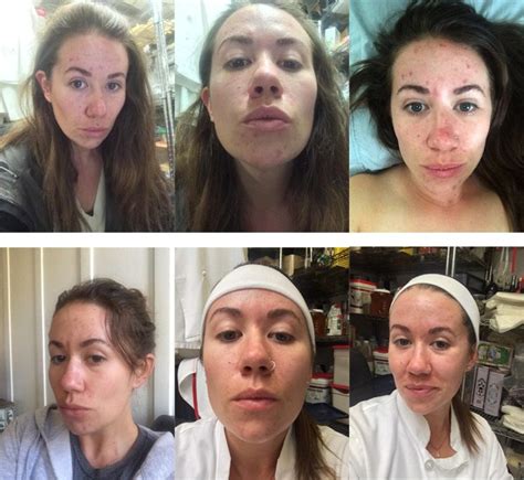 Image result for Oil cleansing method How to Use