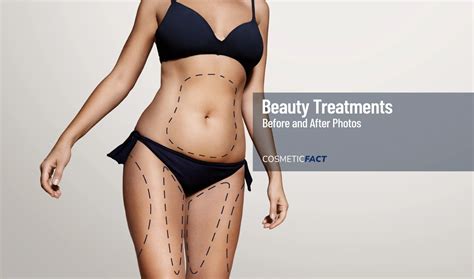 Image result for Body Contouring Surgery
