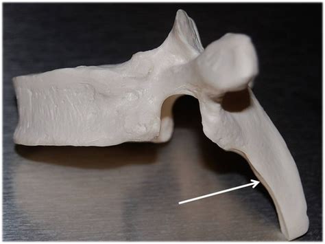 Image result for Sharp Slender Process