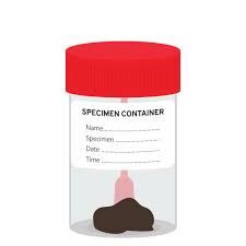 Image result for Stool Sample Collection Bags