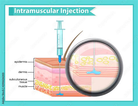 Image result for Intramuscular Injection