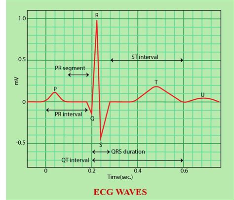 Image result for PR Interval ECG Boxes