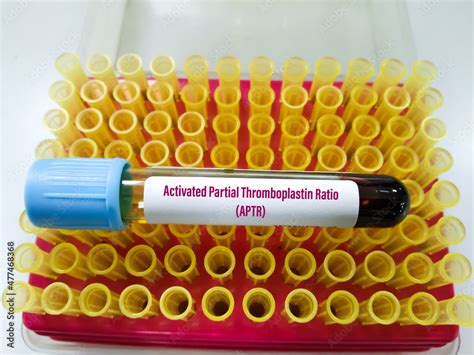 Image result for Apr Tube Testing